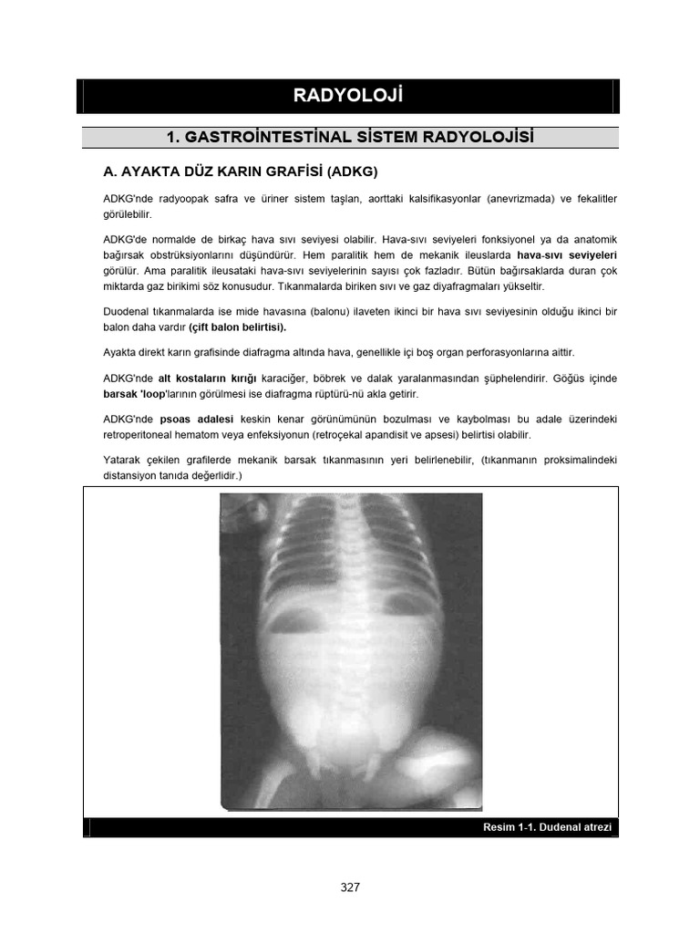 Radyoloji TUMER | PDF