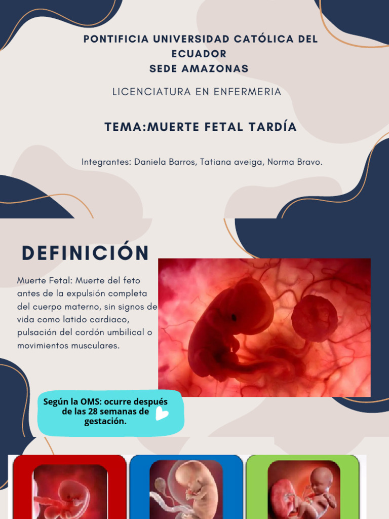 Muerte Fetal Tardía | PDF | El embarazo | Feto
