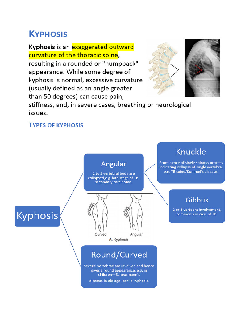 Kyphosis 1 | PDF | Vertebral Column | Musculoskeletal System