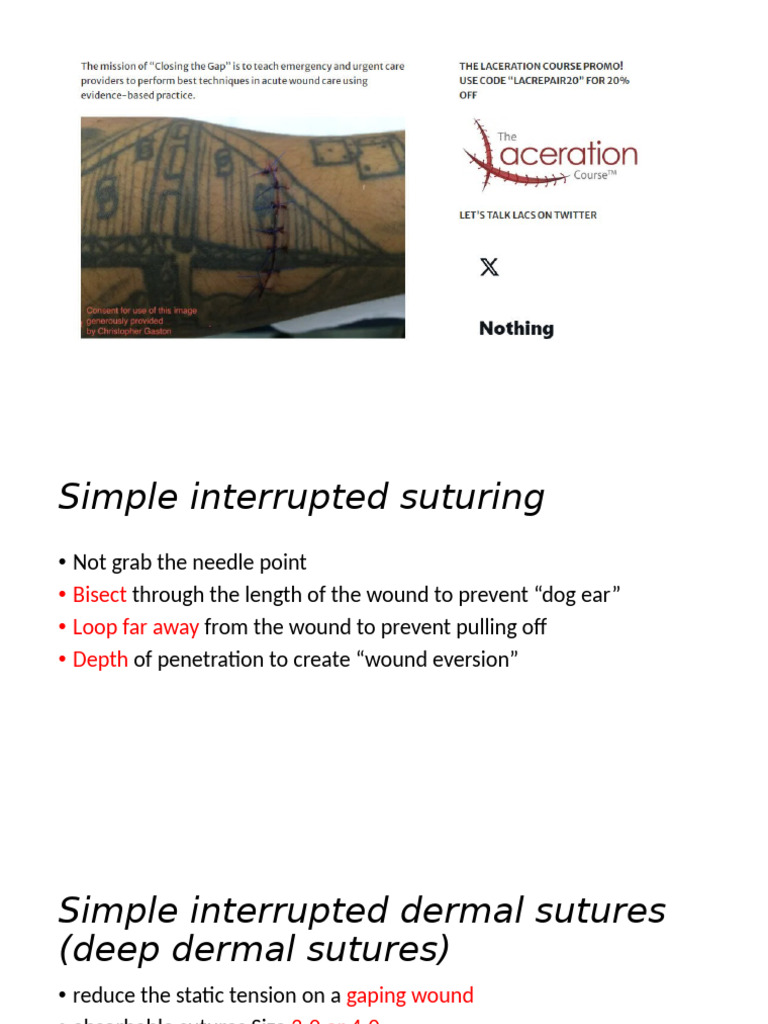 Web Laceration | PDF