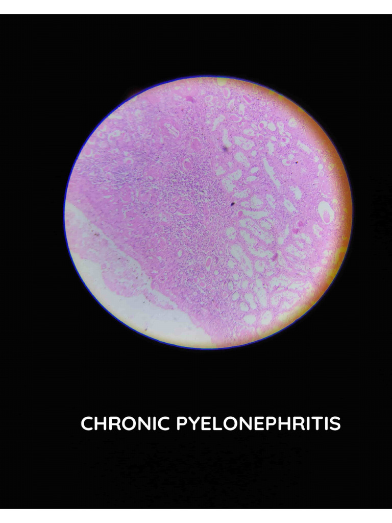 Pathology Slides ? | PDF