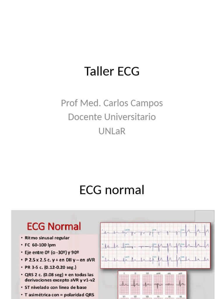 Taller ECG Con Diagnostico Final | PDF