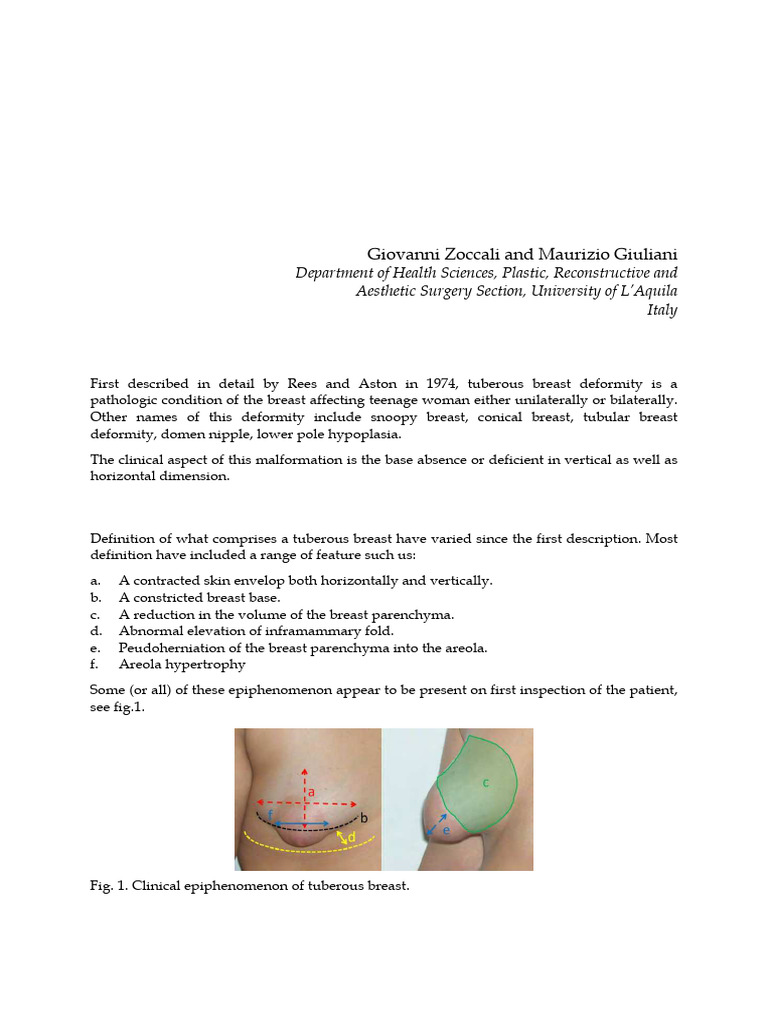 InTech-Tuberous - Breast - Clinical - Evaluation - and - Surgical ...