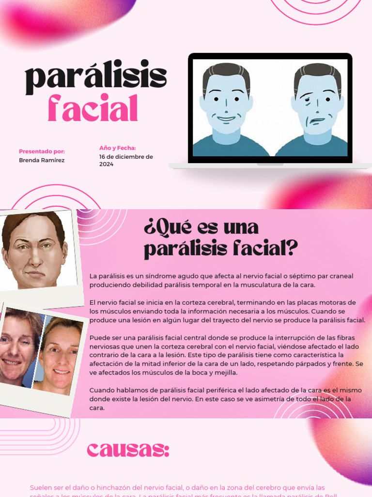Causas y Tratamientos de Parálisis Facial | PDF | Enfermedades y ...