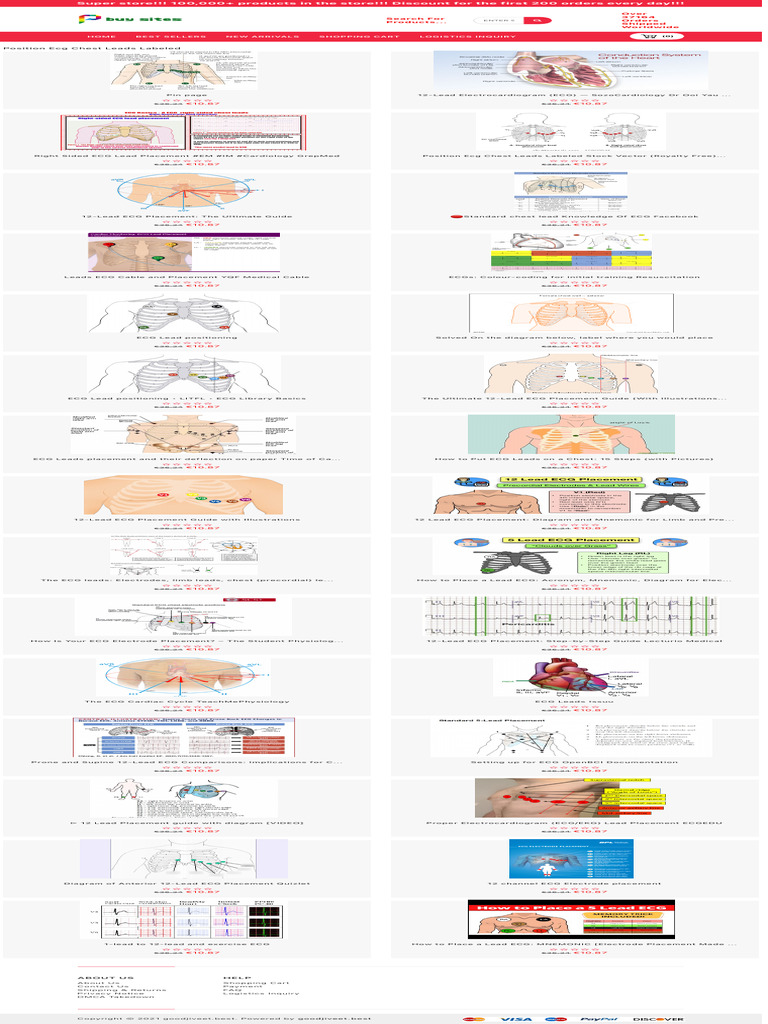 Position Ecg Chest Leads Labeled-Online Store | PDF ...