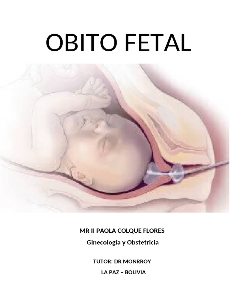 Obito Fetal | PDF