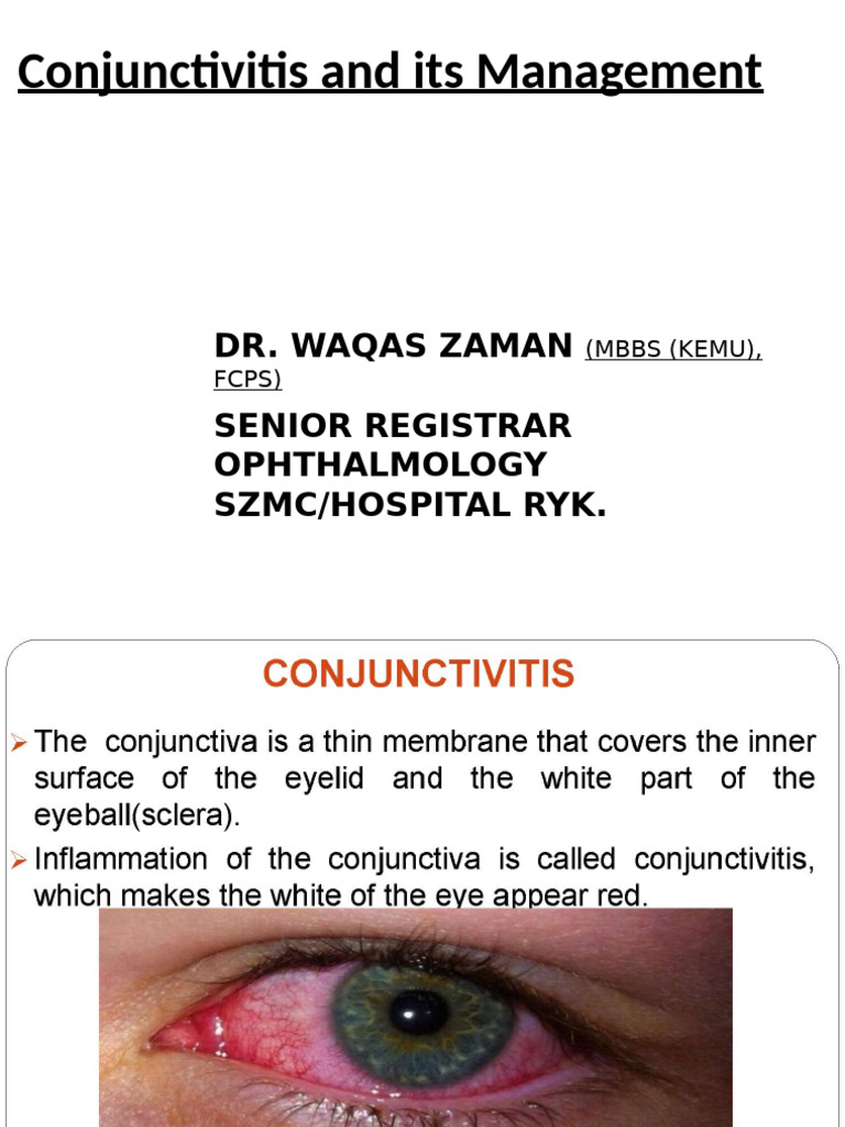 Conjunctivitis | PDF