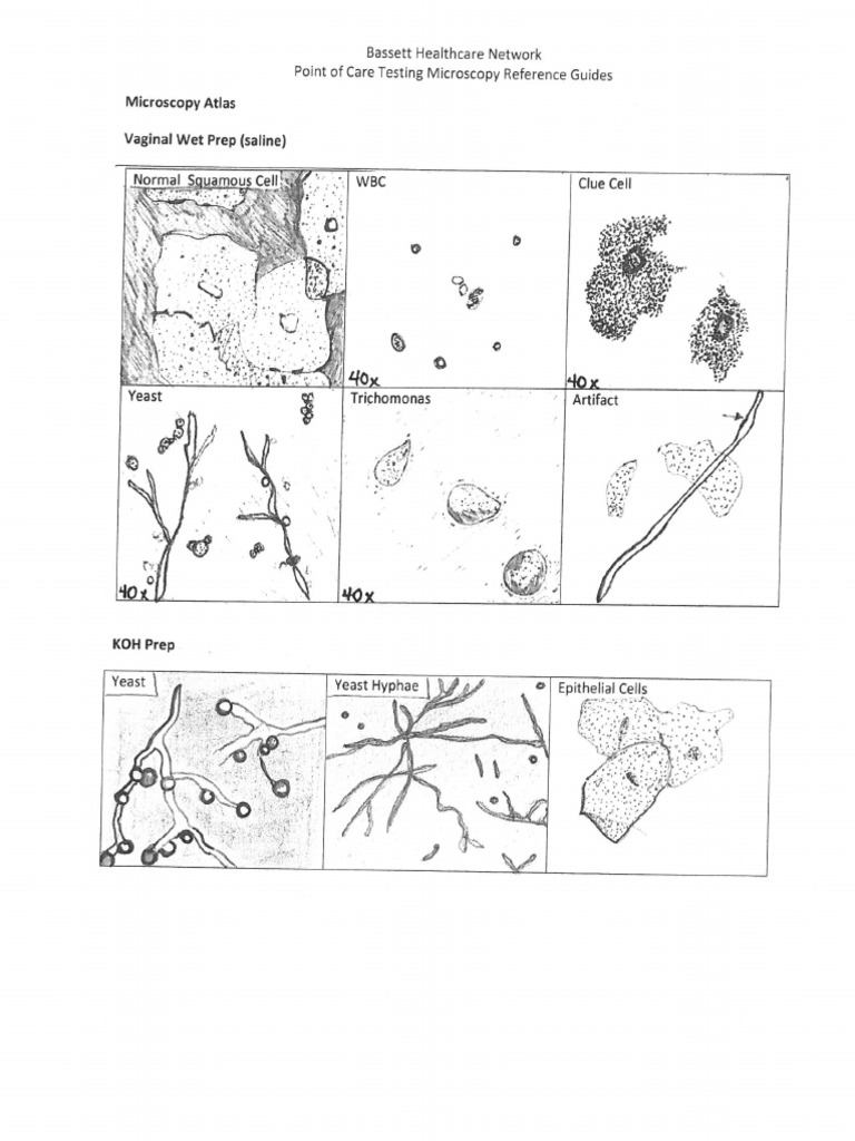 A82b25a Poc Regional Vaginal Wet Prep QC | PDF