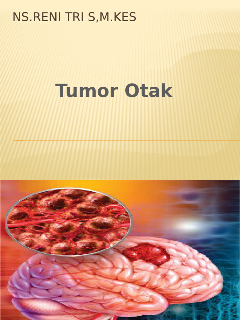 Tumor Otak | PDF