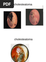 Teed Scale for Ear Barotrauma | PDF