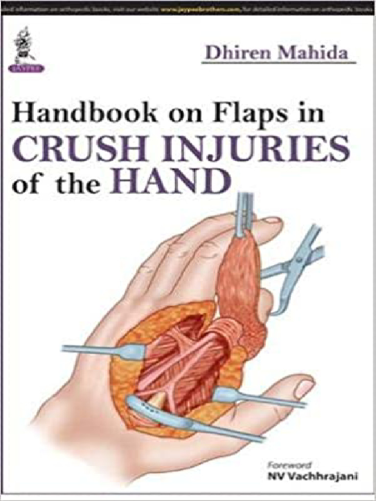 Dhiren Mahida - Handbook On Flaps in Degloving, Avulsion and Crush Injuries of The Hand-Jaypee ...