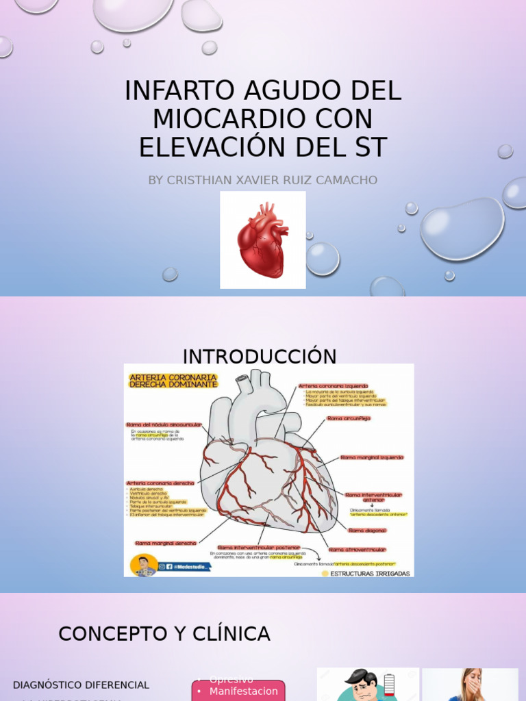 Infarto Agudo Del Miocardio Con Elevación Del St | PDF | Infarto de ...