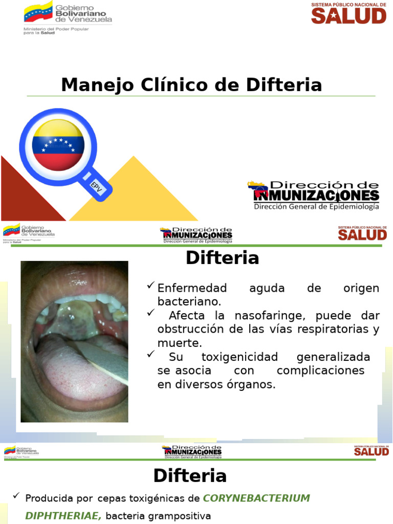Difteria Manejo Clinico 2024 | PDF | Inmunología | Especialidades Medicas
