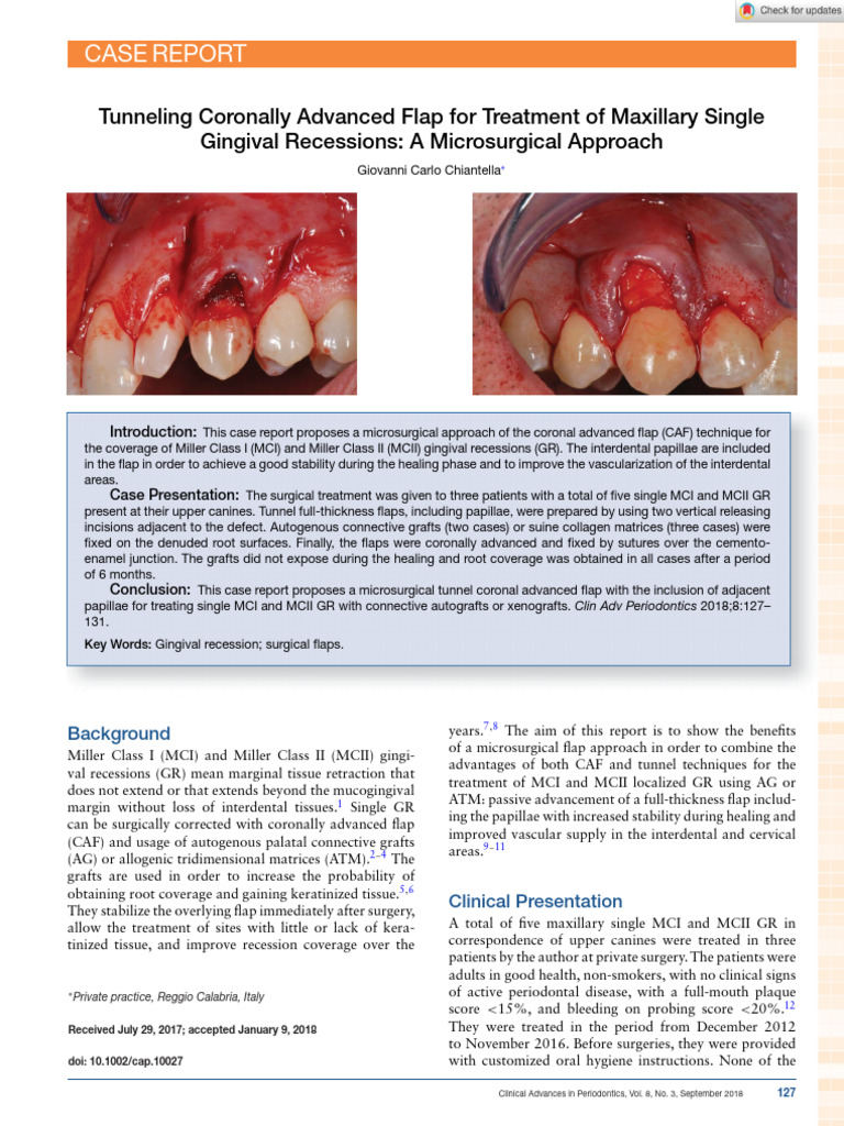 Clin Adv Periodontics - 2018 - Chiantella - Tunneling Coronally ...
