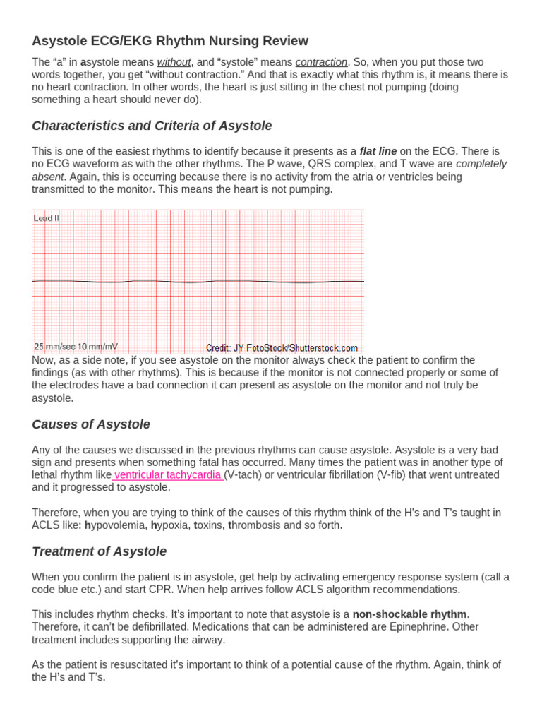 ASYSTOLE | PDF