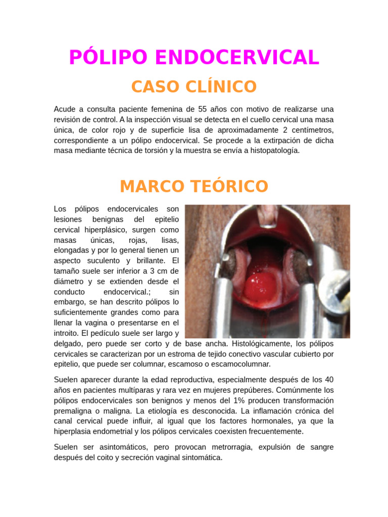Pólipo Endocervical: Diagnóstico y Tratamiento | PDF | Vagina ...