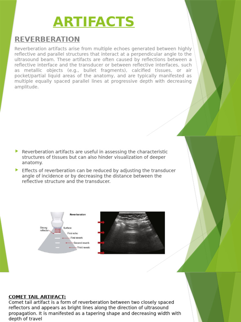 Understanding Ultrasound Reverberation Artifacts | PDF