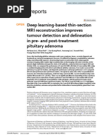 The Evans' Index Revisited | PDF | Sensitivity And Specificity | Neurology