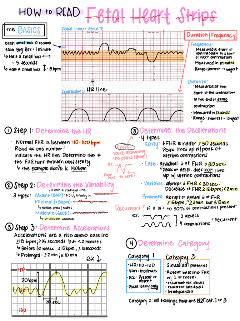 Reading Fetal Heart Monitor Strips | PDF | Medical Specialties | Human ...