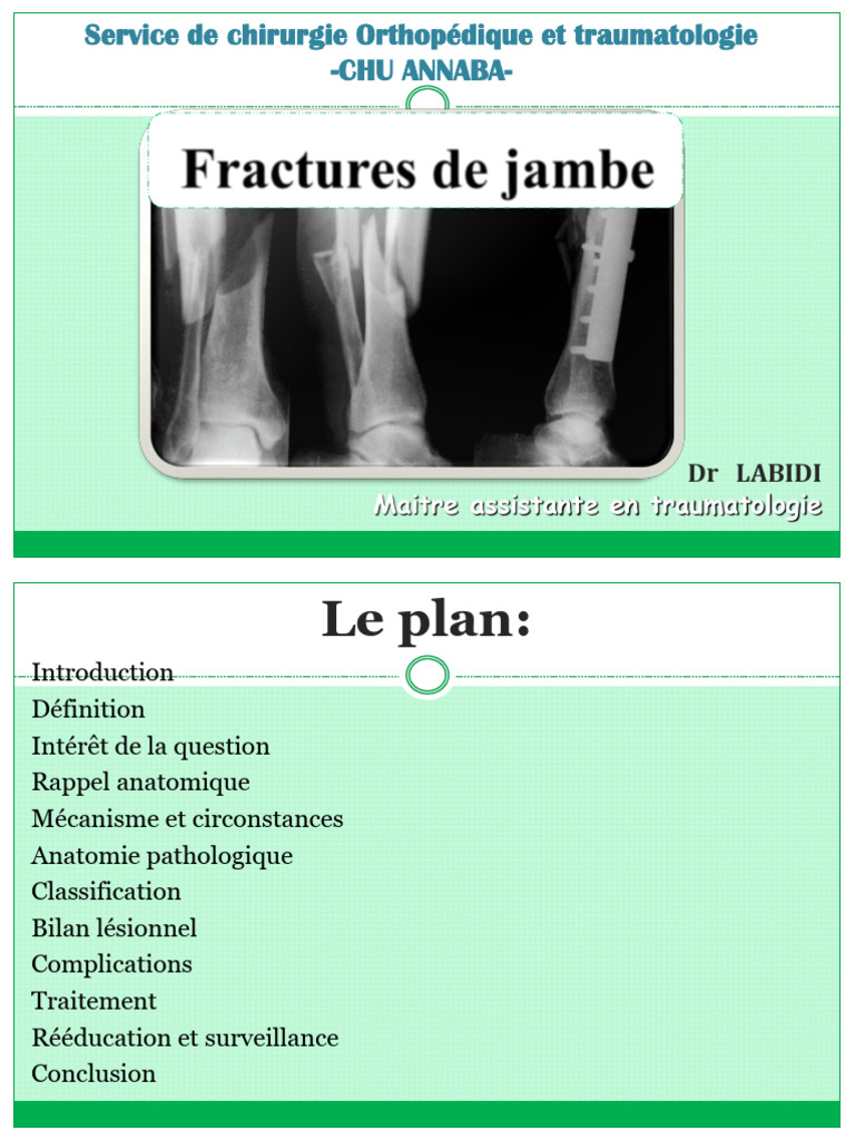 Fractures de jambe : diagnostic et traitement | PDF | Jambe humaine ...