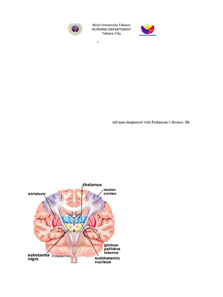 Case-Presentation-Lupango, Glaiza Angelica B. | PDF | Basal Ganglia ...