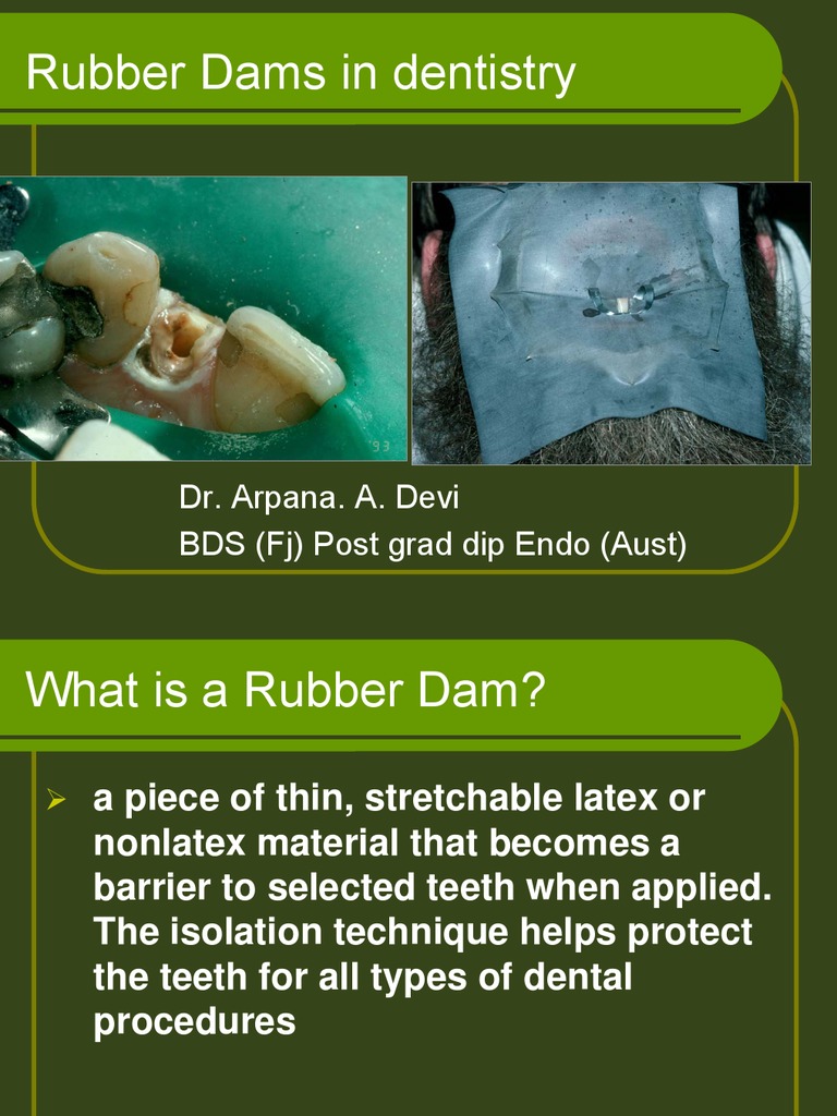 Rubber Dam Lecture | PDF | Dentistry | Mouth