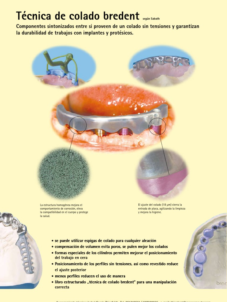 Técnica de Colado - E | PDF | Revestimiento | Aluminio