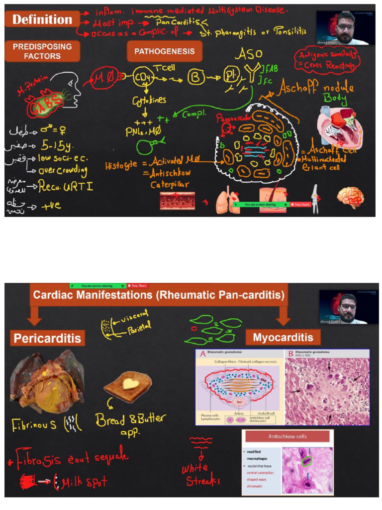 Patho by Dr.ahmed Elnemr [CVS][5] | PDF | Heart | Streptococcus
