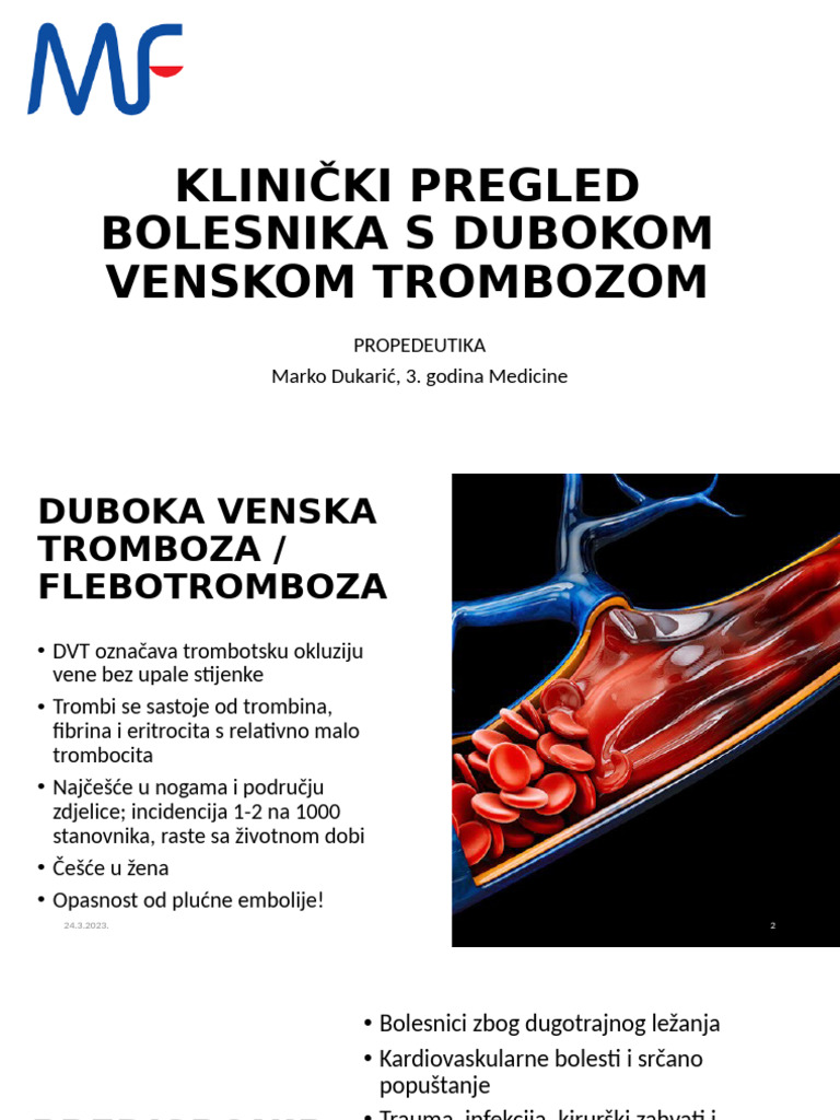 DVT.pptx | PDF