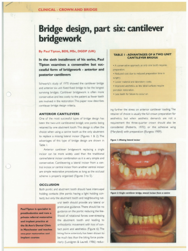 Bridge Design Part 6 | PDF