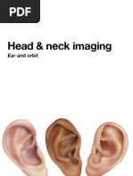 Trotter's Method for Managing Epistaxis | PDF | Clinical Medicine ...