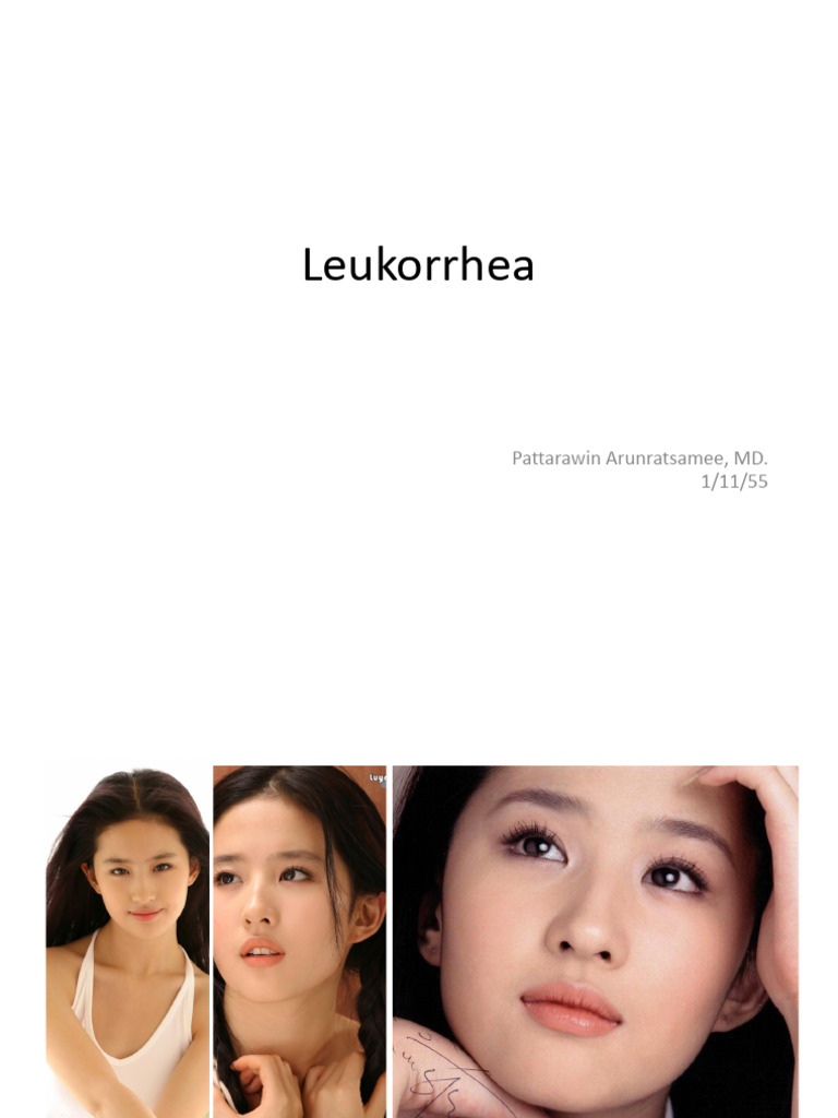 Leukorrhea | PDF