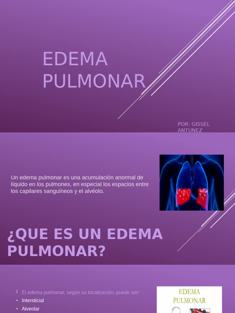 Edema Pulmonar | PDF | Medicina CLINICA | Especialidades Medicas