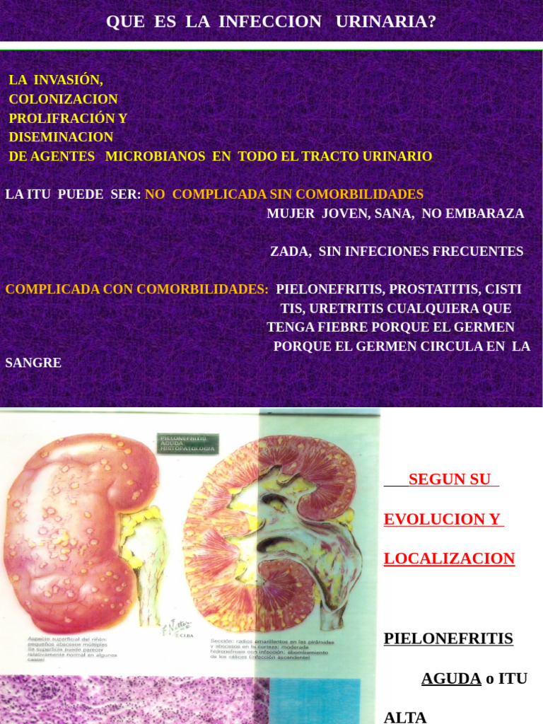 Infeccion Urinaria | PDF | Infección del tracto urinario | Inflamación