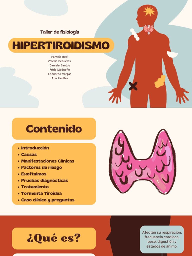 Hipertiroidismo | PDF | Hipertiroidismo | Tiroides