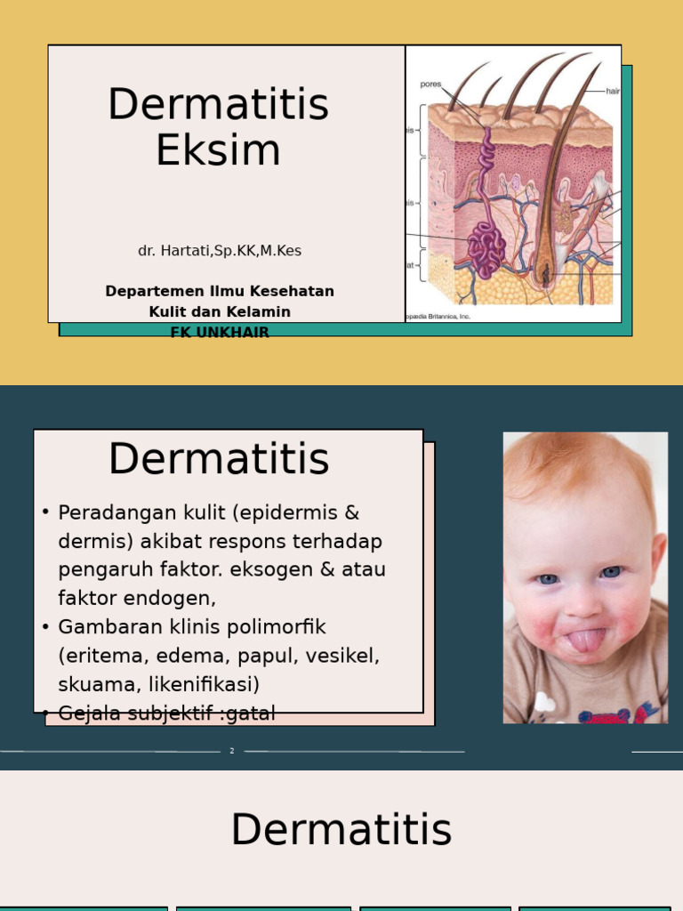 Dermatitis Eksim | PDF