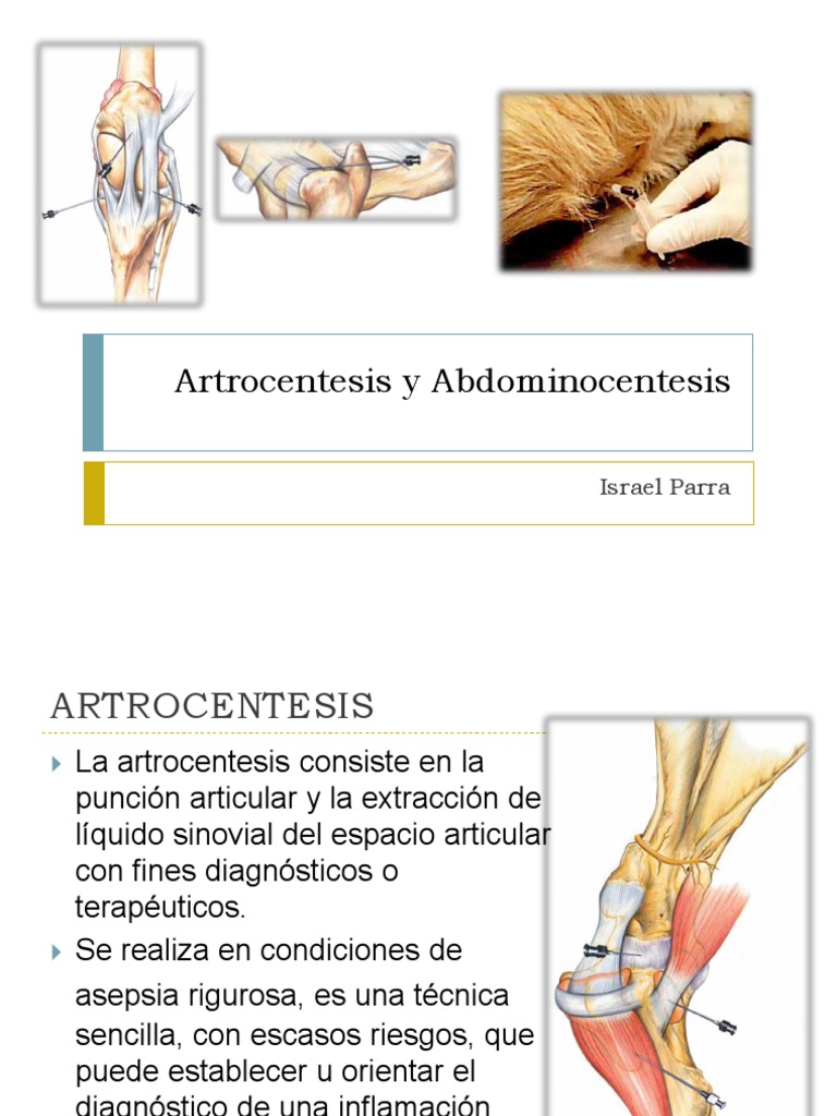 Artrocentesis y Abdominocentesis | PDF | Medicina CLINICA | Ciencias de ...
