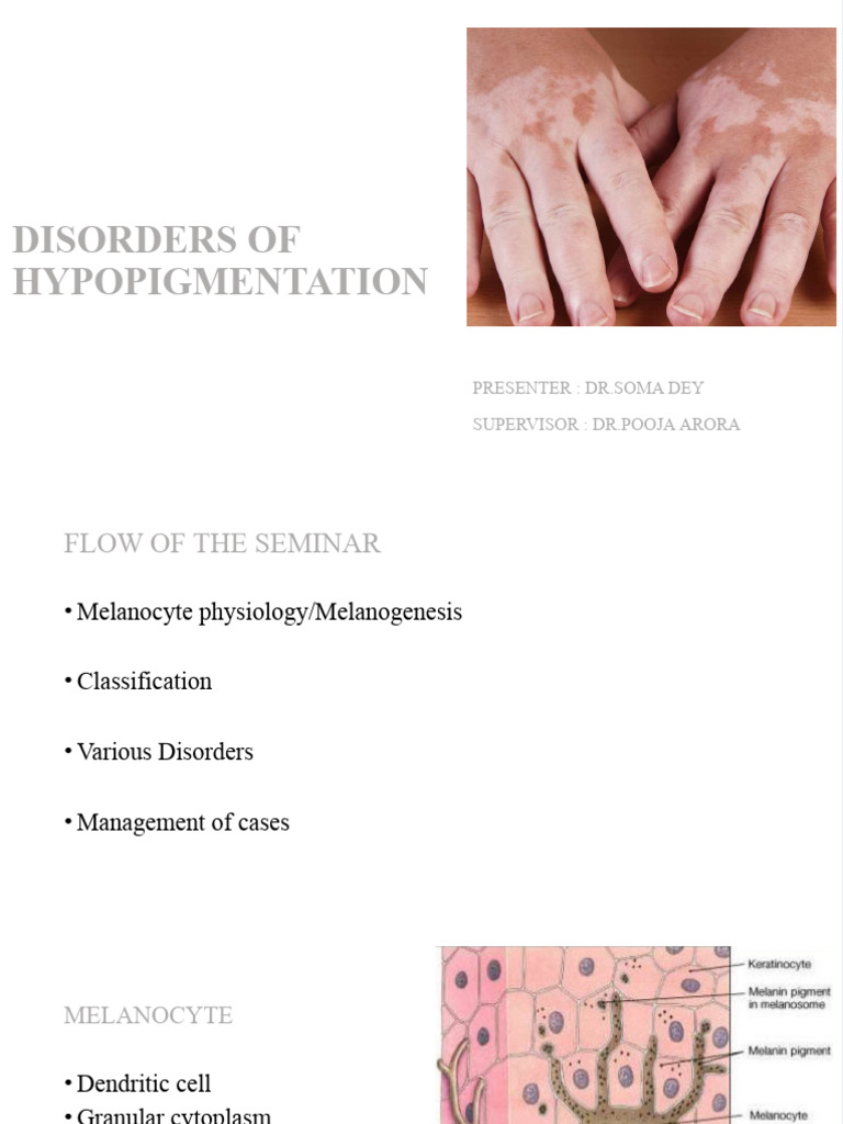 Hypopigmentation Disorders | PDF | Skin | Diseases And Disorders