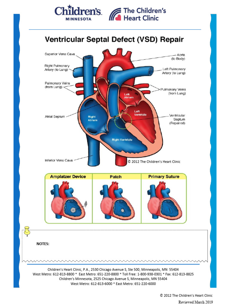 Ventricular Septal Defect VSD Repair | PDF | Cardiovascular System | Heart