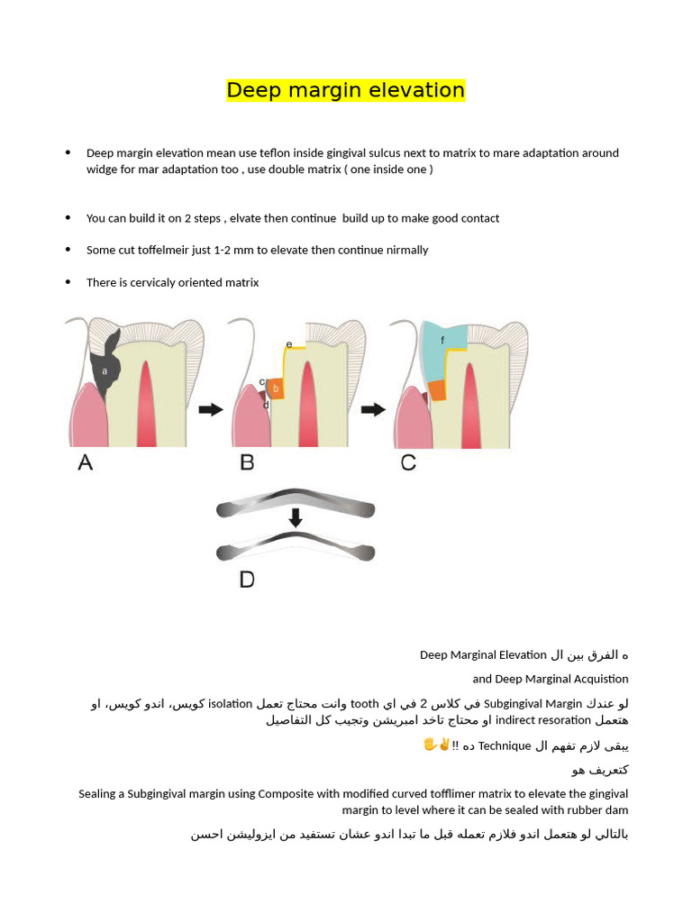 Deep Margin Elevation | PDF