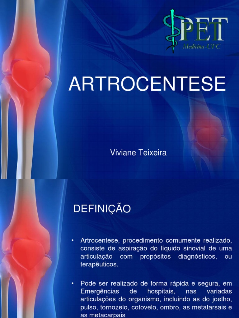 Artrocentese: Indicações e Procedimentos | PDF | Imunologia | Ciências ...