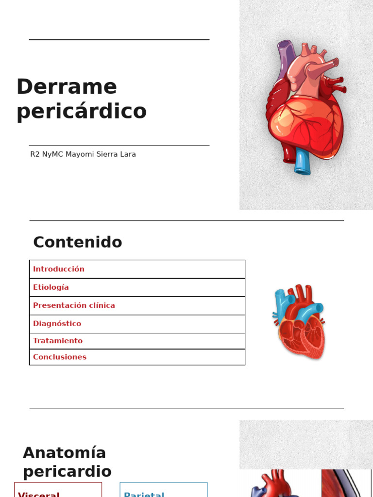 Derrame Pericardico y Tamponade Cardíaco-2 | PDF | Corazón | Especialidades Medicas