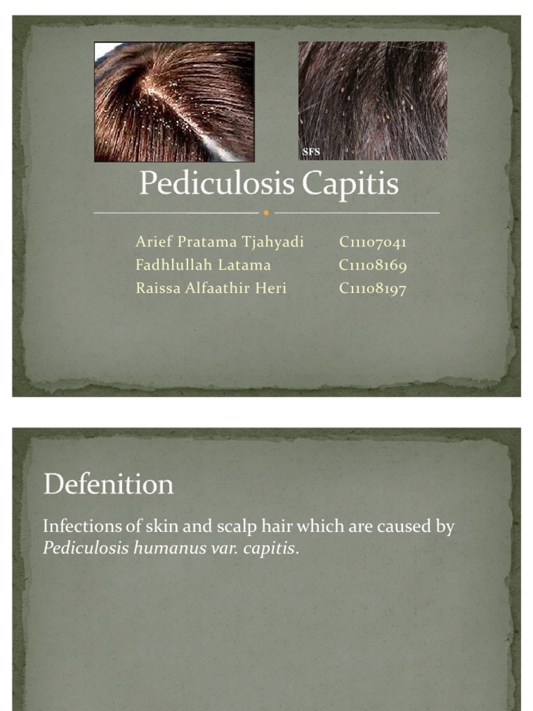 Pediculosis Capitis | PDF | Science & Mathematics