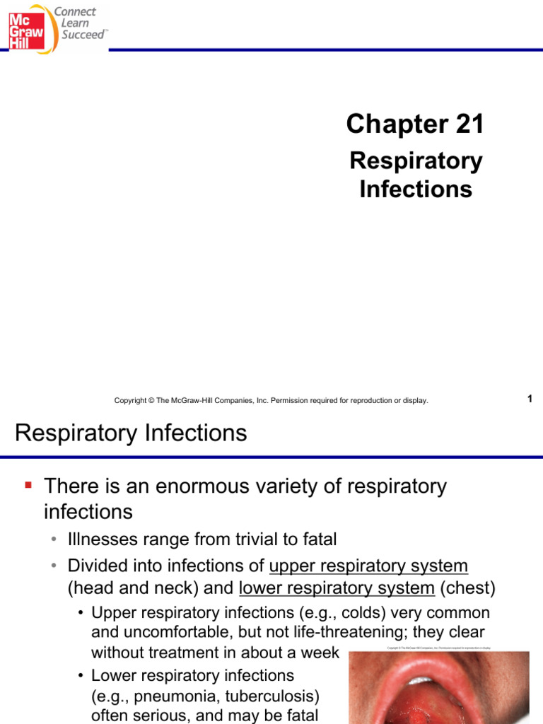 Overview of Respiratory Infections | PDF | Influenza | Pneumonia