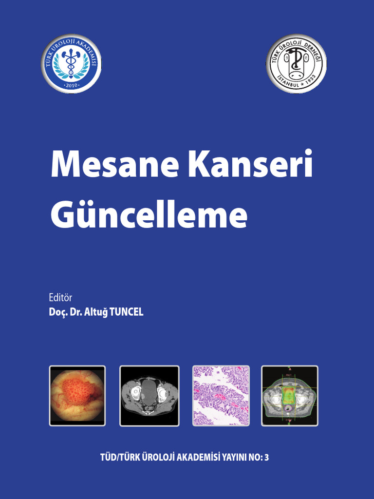 Mesane Kanseri Guncelleme | PDF