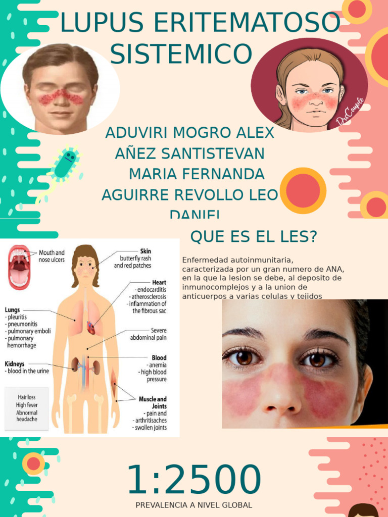 LUPUS ERITEMATOSO SISTEMICO-PATOLOGIA | PDF