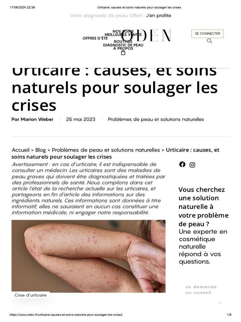 Urticaire : causes et remèdes naturels | PDF | Acides gras oméga-3 | Peau
