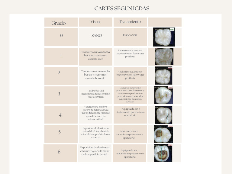 Caries Segun ICDAS | PDF