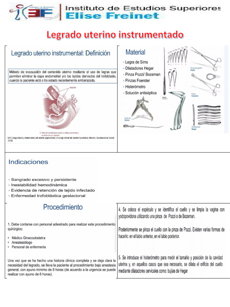 Legrado uterino instrumentado 2 | PDF