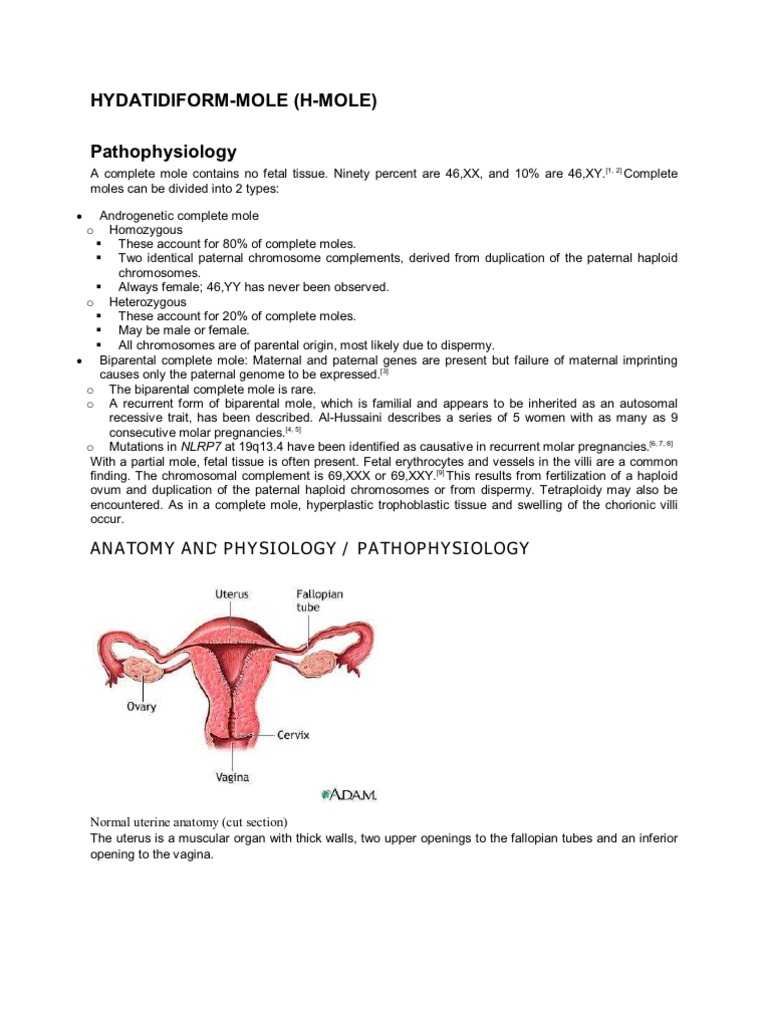 Hydatidiform Mole Overview and Pathophysiology | PDF